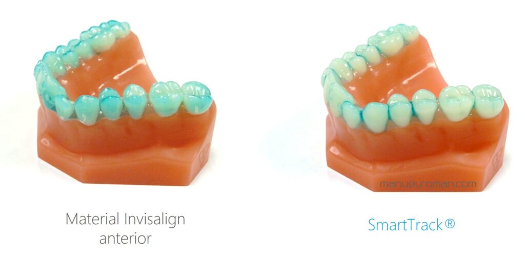 SmartTrack - El material de Invisalign - manuelroman.com | ortodoncia ...