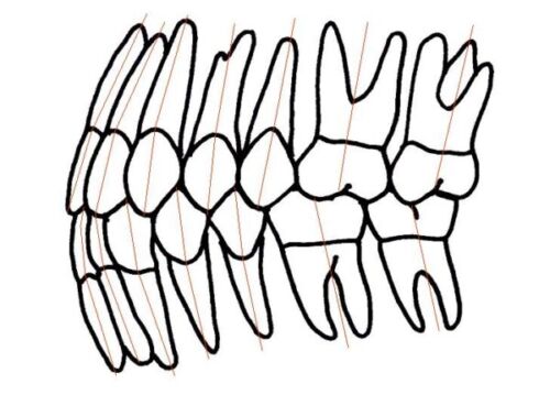 Las seis claves de la oclusión normal en ortodoncia | manuelroman.com
