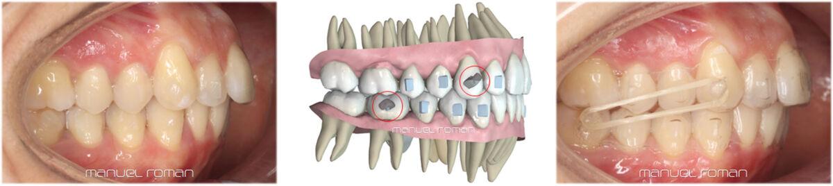 Ganchos integrados SPARK - Approver R13 | manuelroman.com